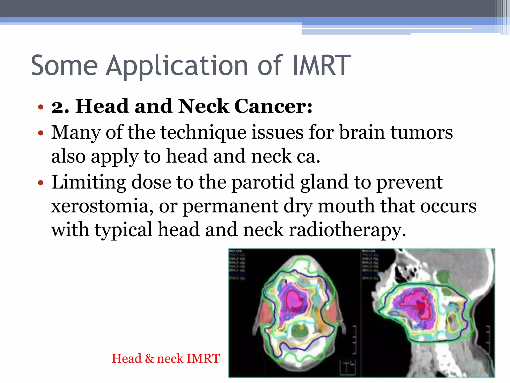 IMRT: Intensity Modulated Radiotherapy | PPTX