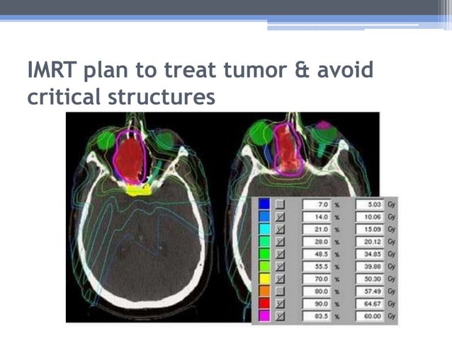 IMRT: Intensity Modulated Radiotherapy | PPTX | Cancer | Diseases and ...