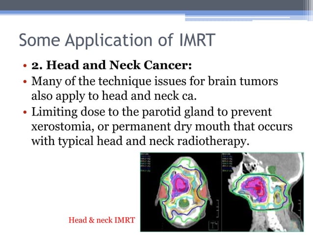IMRT: Intensity Modulated Radiotherapy | PPTX | Cancer | Diseases and ...