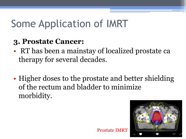 IMRT: Intensity Modulated Radiotherapy | PPTX | Cancer | Diseases and ...