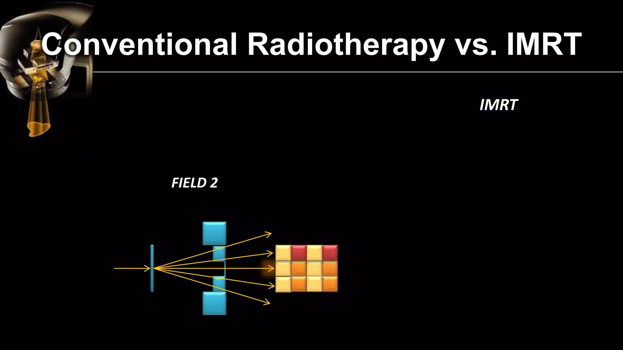 Intensity Modulated Radiation Therapy (IMRT) | PDF