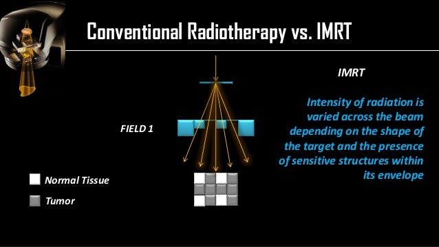 Intensity Modulated Radiation Therapy (IMRT)