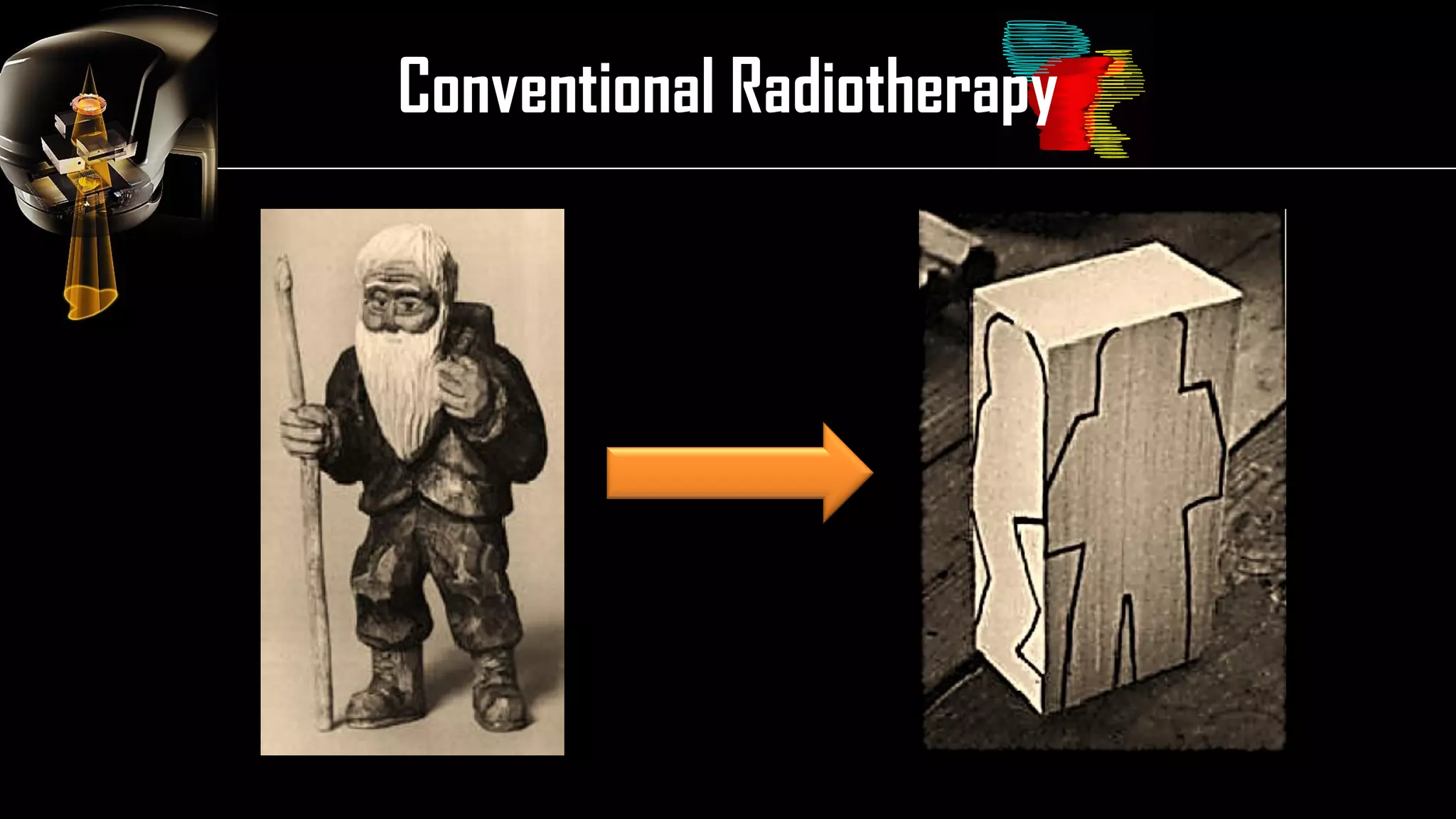 Intensity Modulated Radiation Therapy (IMRT) | PDF