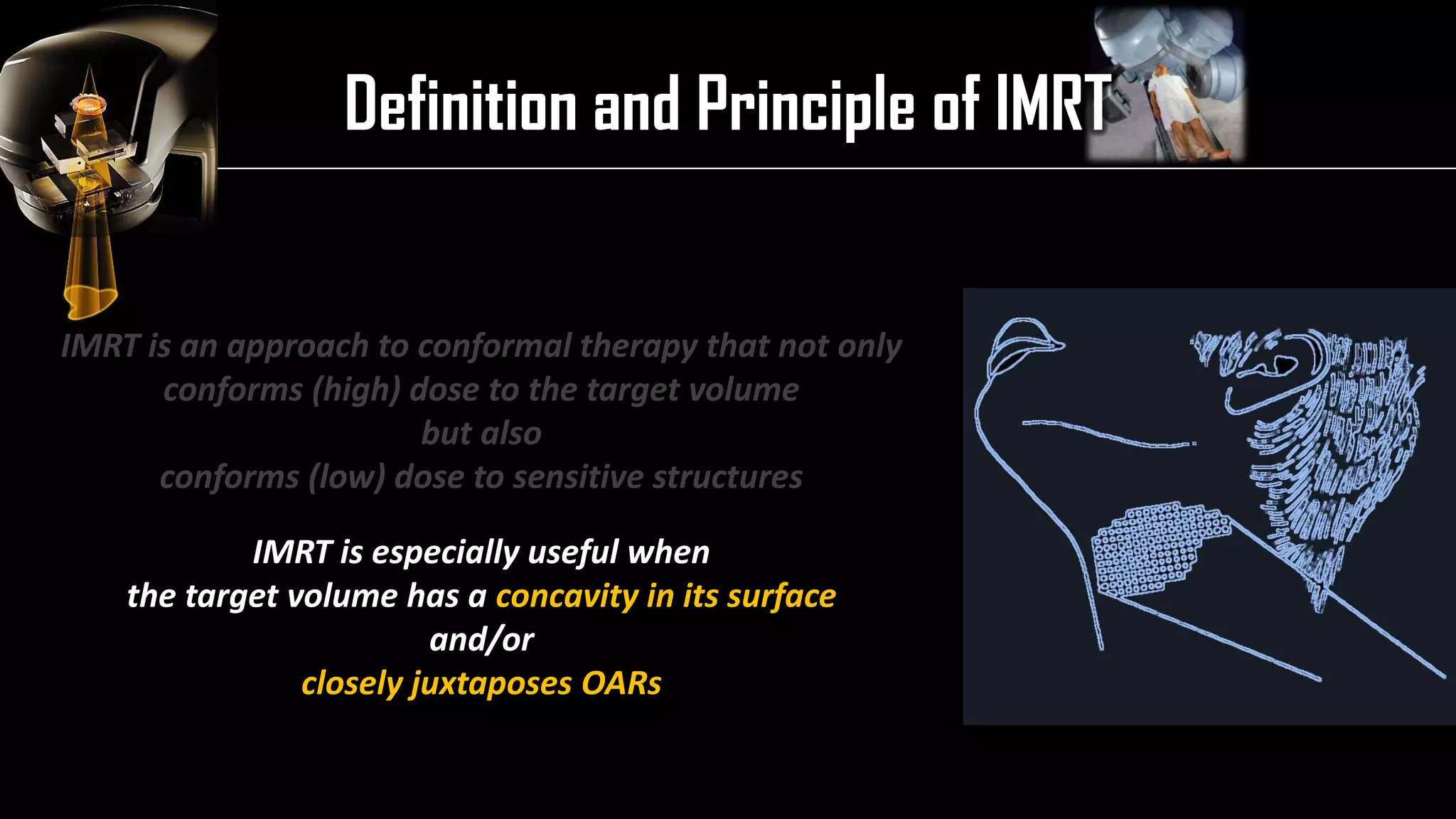 Intensity Modulated Radiation Therapy (IMRT) | PDF