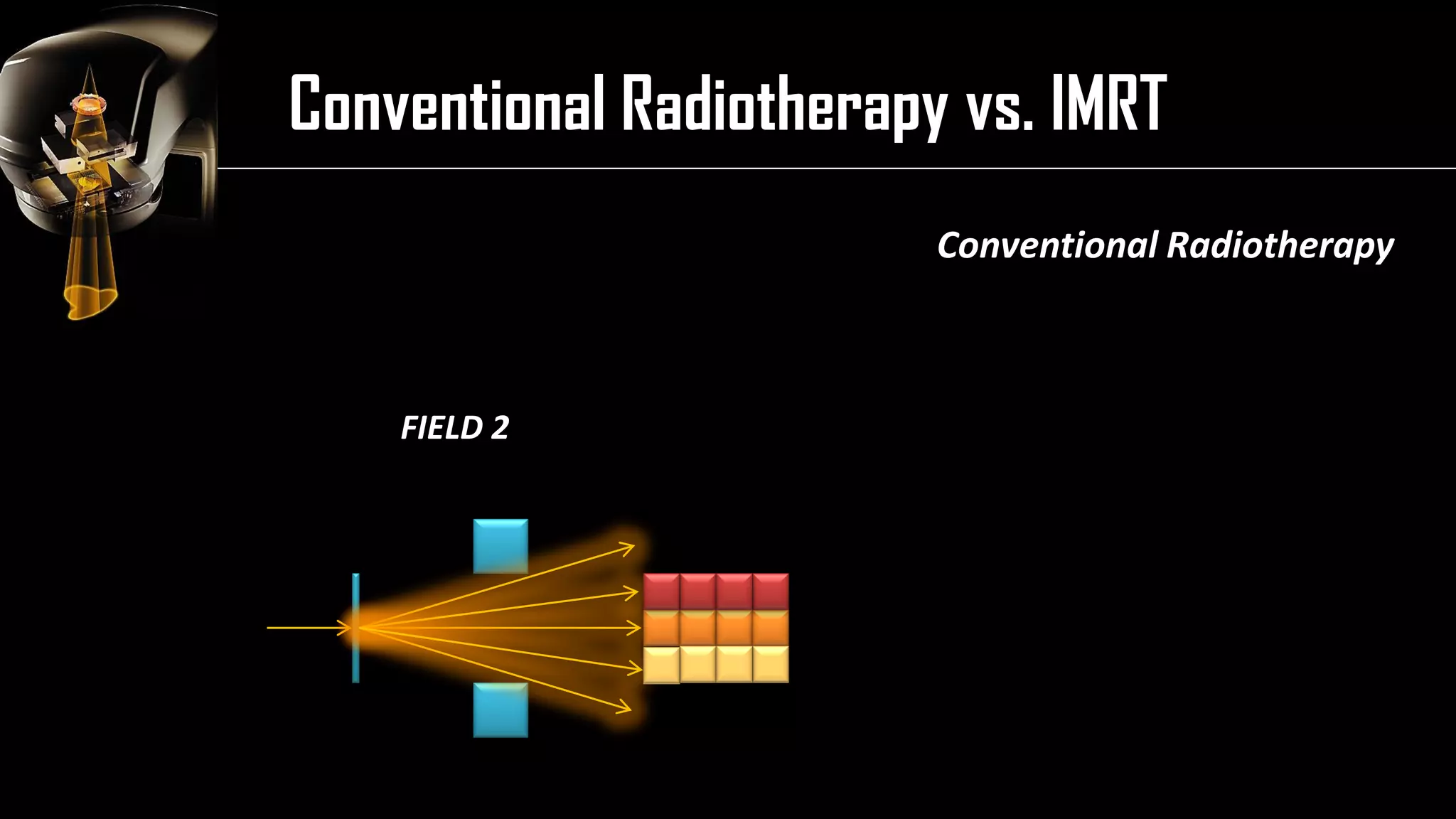 Intensity Modulated Radiation Therapy (IMRT) | PDF