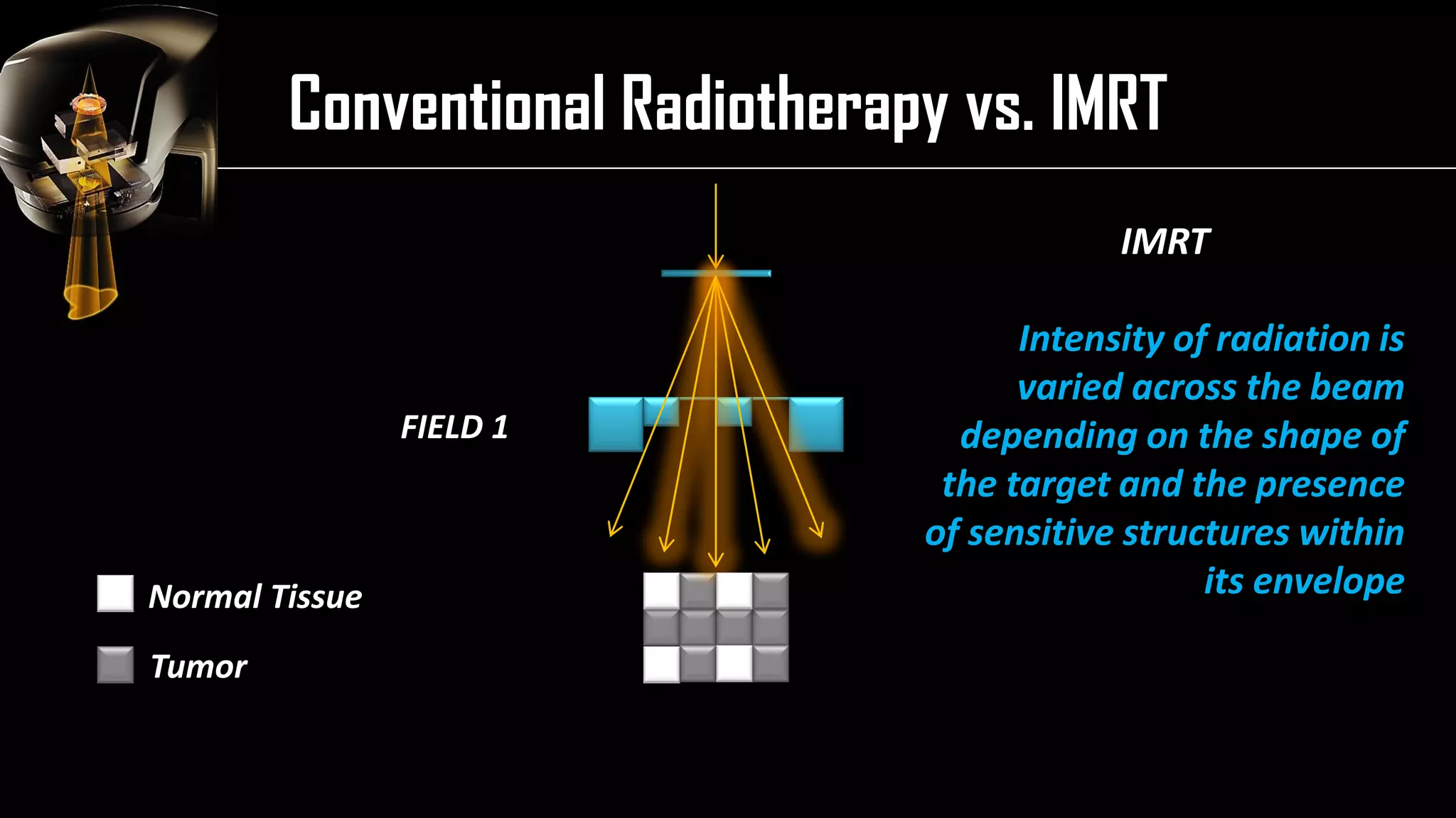 Intensity Modulated Radiation Therapy (IMRT) | PDF