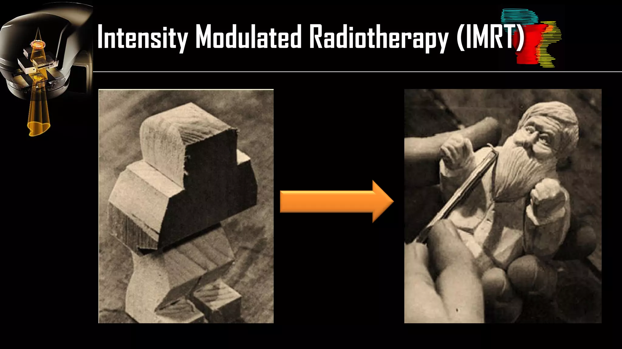 Intensity Modulated Radiation Therapy (IMRT) | PDF
