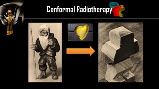 Intensity Modulated Radiation Therapy (IMRT) | PDF