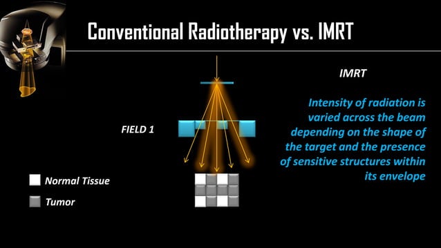 Intensity Modulated Radiation Therapy (IMRT) | PDF