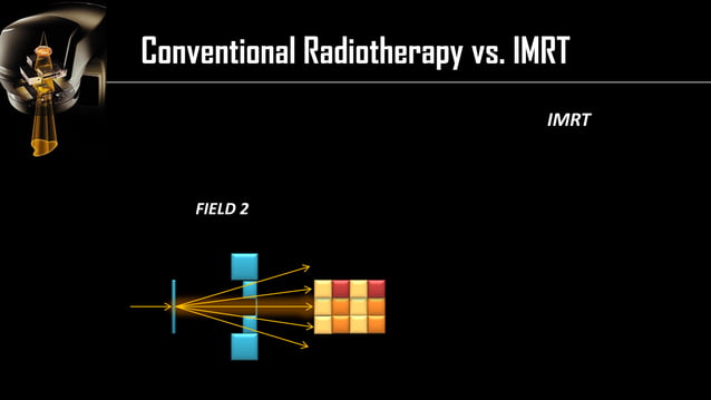 Intensity Modulated Radiation Therapy (IMRT) | PDF