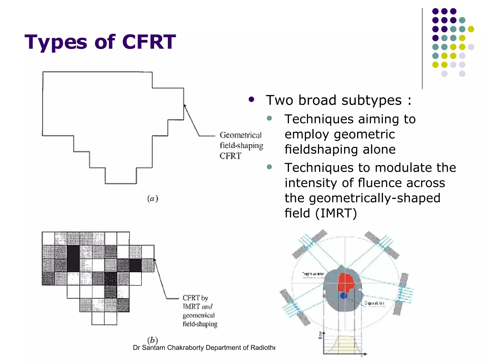 IMRT and 3D CRT in cervical Cancers | ODP