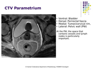 IMRT and 3D CRT in cervical Cancers | ODP