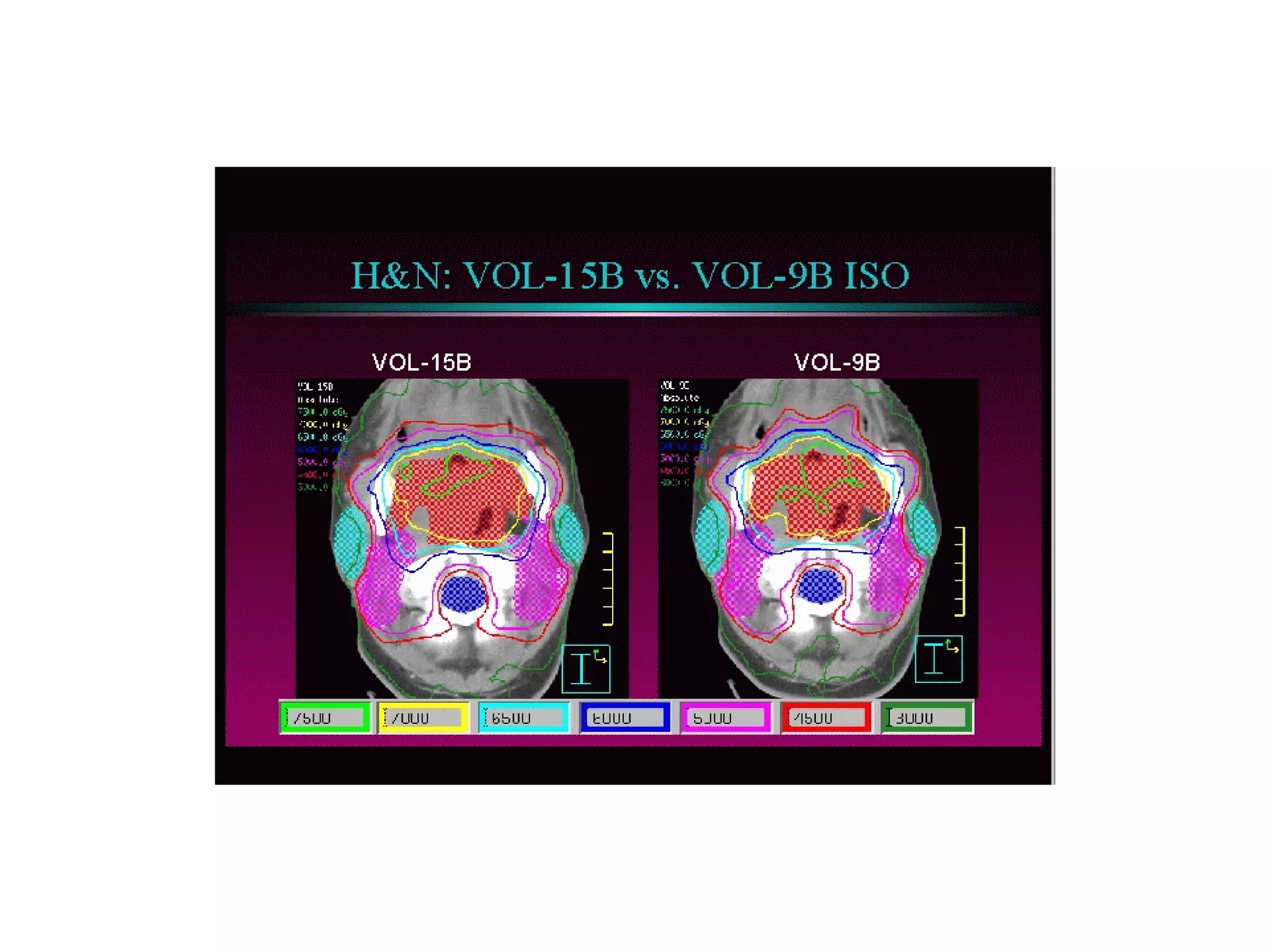 Optimization of IMRT plans | PPT