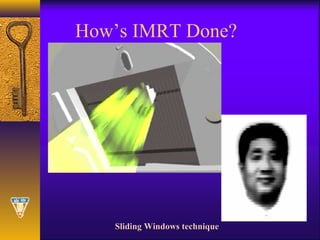 Imrt state of the art | PPT