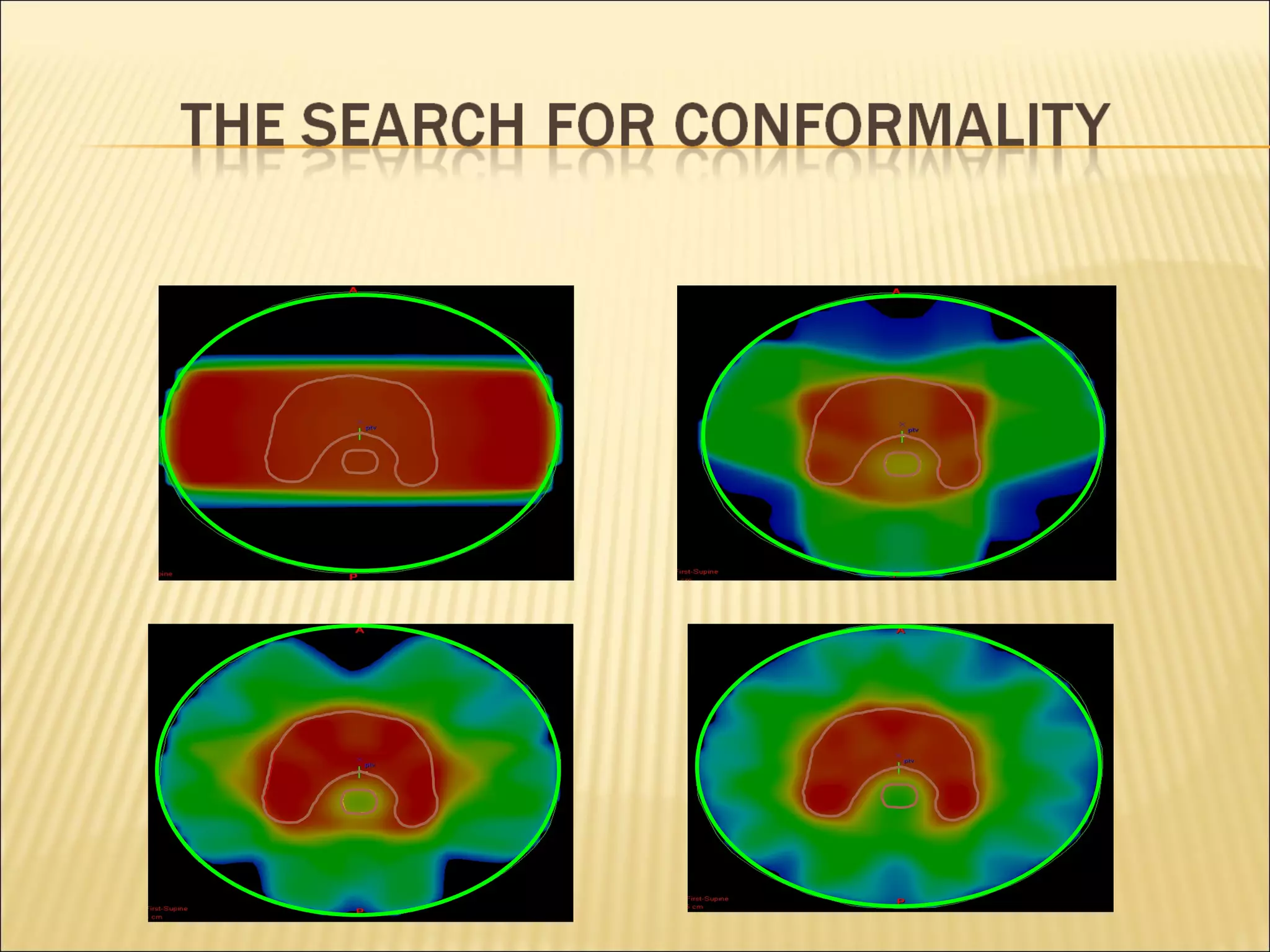 IMRT in Head & Neck Cancer | PPT