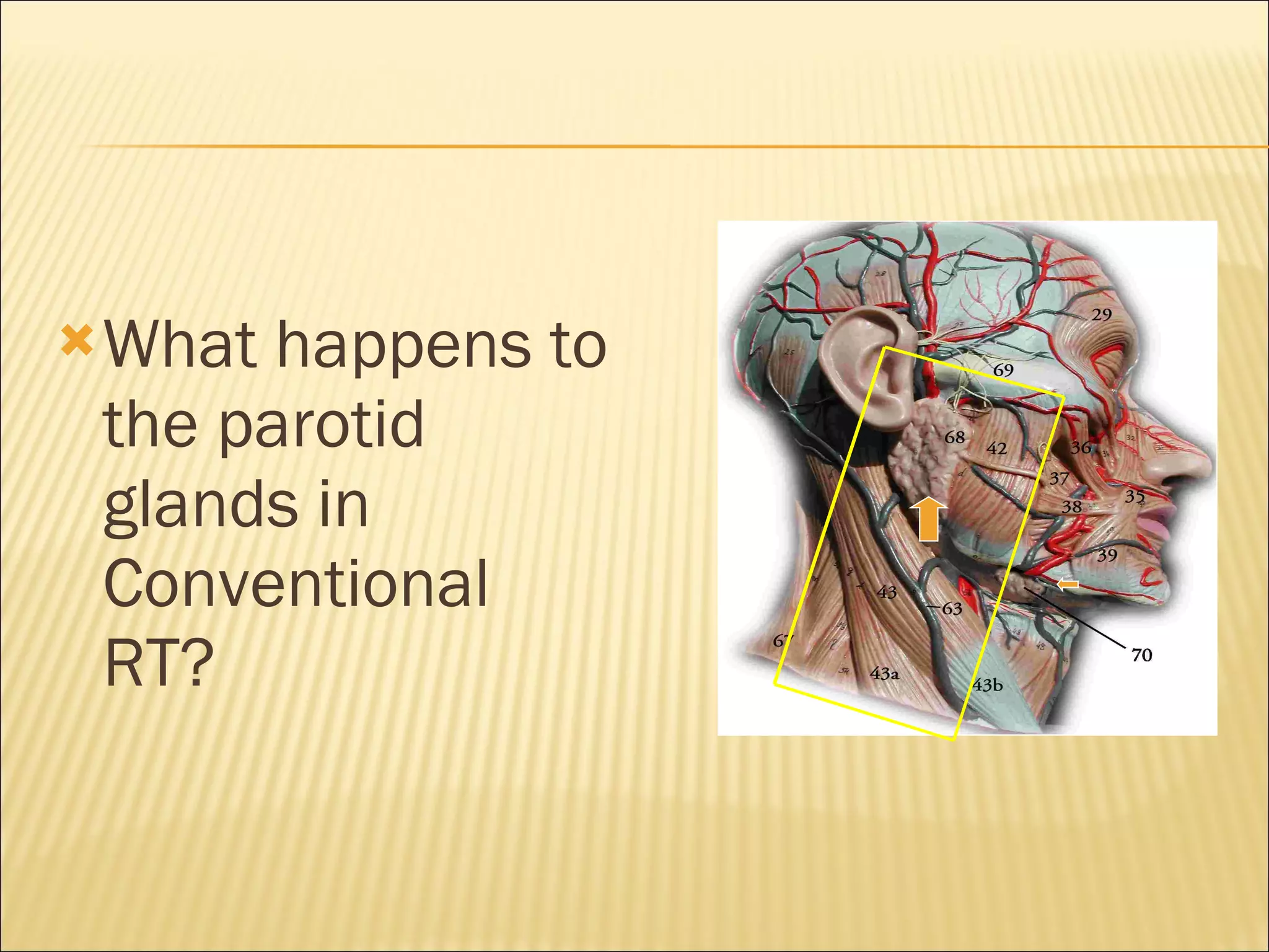 IMRT in Head & Neck Cancer | PPT