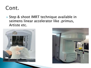 Imrt delivery | PPTX