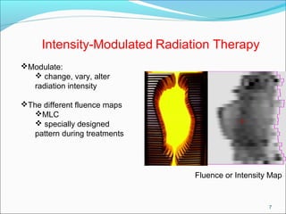 introduction to Intensity modulated radiation therapy | PPT