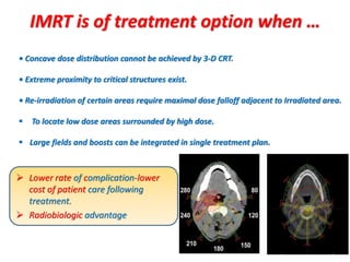 Imrt&vmat | PDF