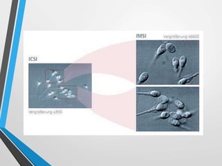 INTRACYTOPLASMIC MORPHOLOGICALLY SELECTED SPERM INJECTION (IMSI).pptx