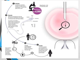 INTRACYTOPLASMIC MORPHOLOGICALLY SELECTED SPERM INJECTION (IMSI).pptx