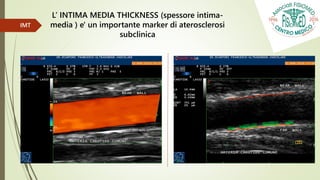 Imt doppler, marker di malattie ateroslerotiche | PPT