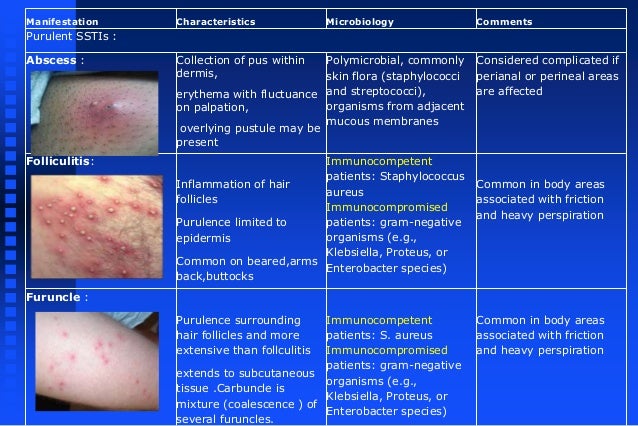 Management of skin and soft tissue infections with ayurveda w.s.r, ra…