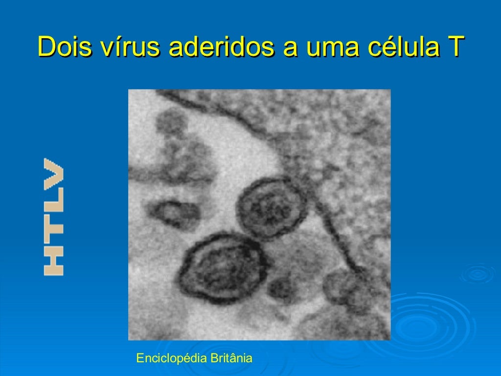HTLV - Vírus linfotrópico de células T humano