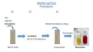 IMViC biochemical tests | PPTX