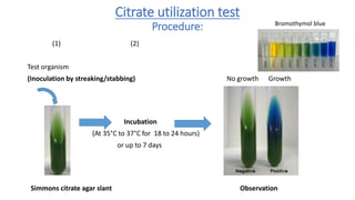IMViC biochemical tests | PPTX