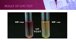 IMVIC lecture video ppt.pptx