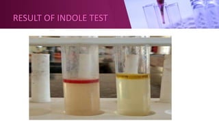 IMVIC lecture video ppt.pptx