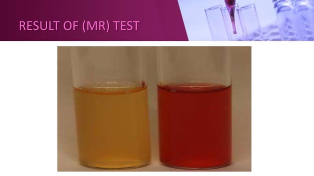 IMVIC lecture video ppt.pptx