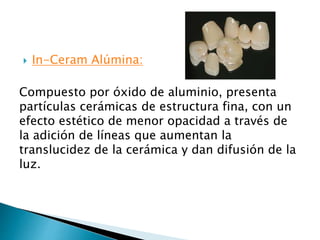 In-Ceram | PPTX