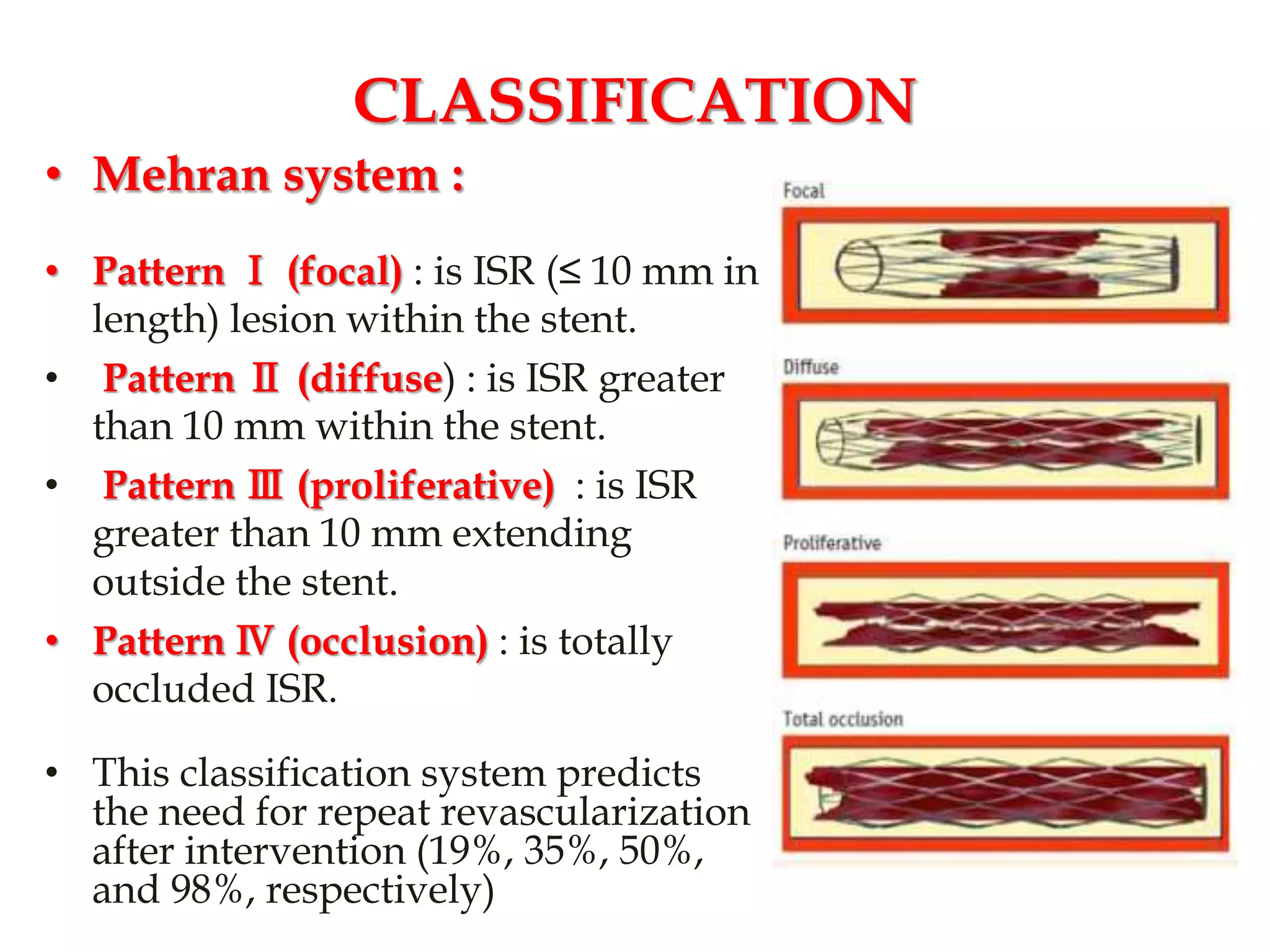 In stent restenosis | PPTX