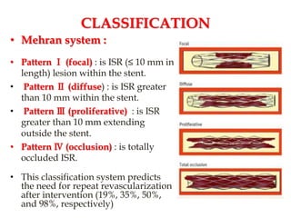 In stent restenosis | PPT