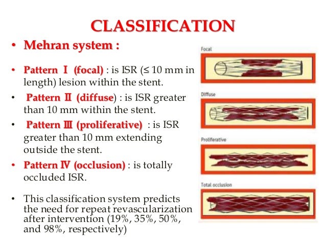 In stent restenosis