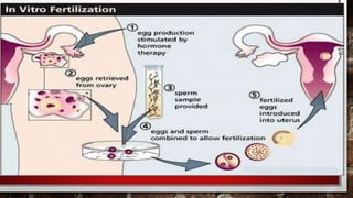 in-vitro-fertilization-artificial insemination.pptx