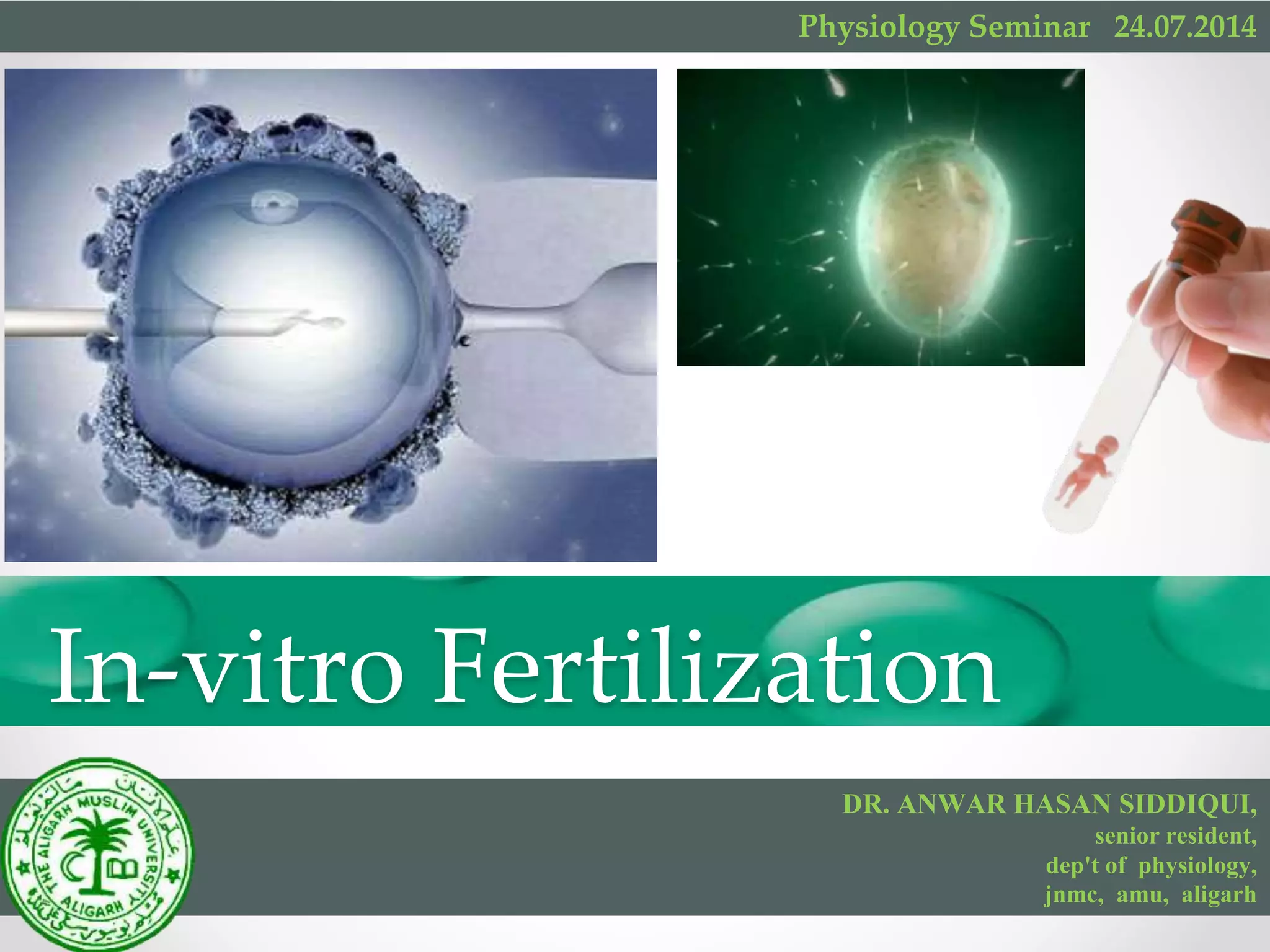In vitro fertilization | PPTX