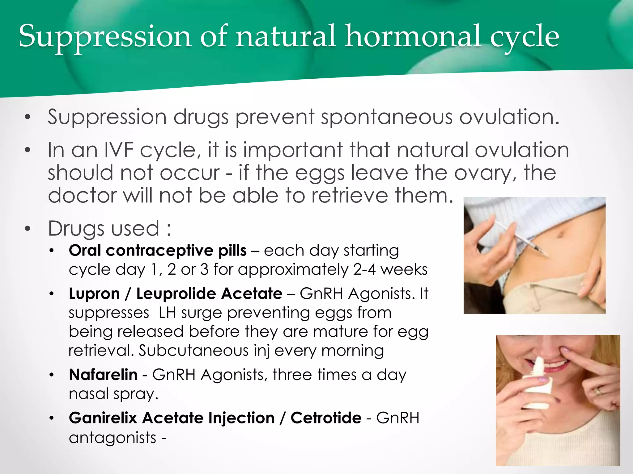 In vitro fertilization | PPTX