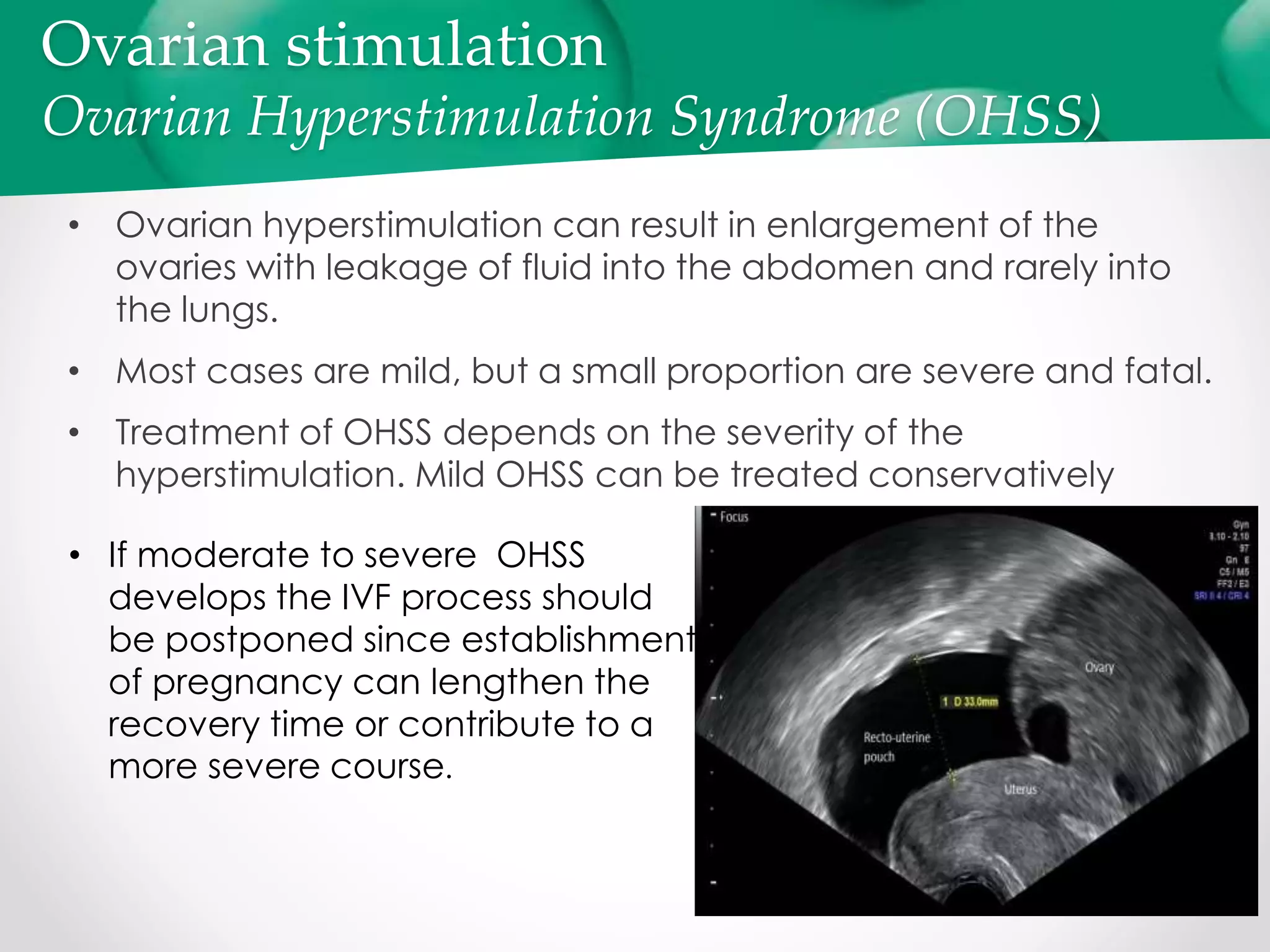 In vitro fertilization | PPTX
