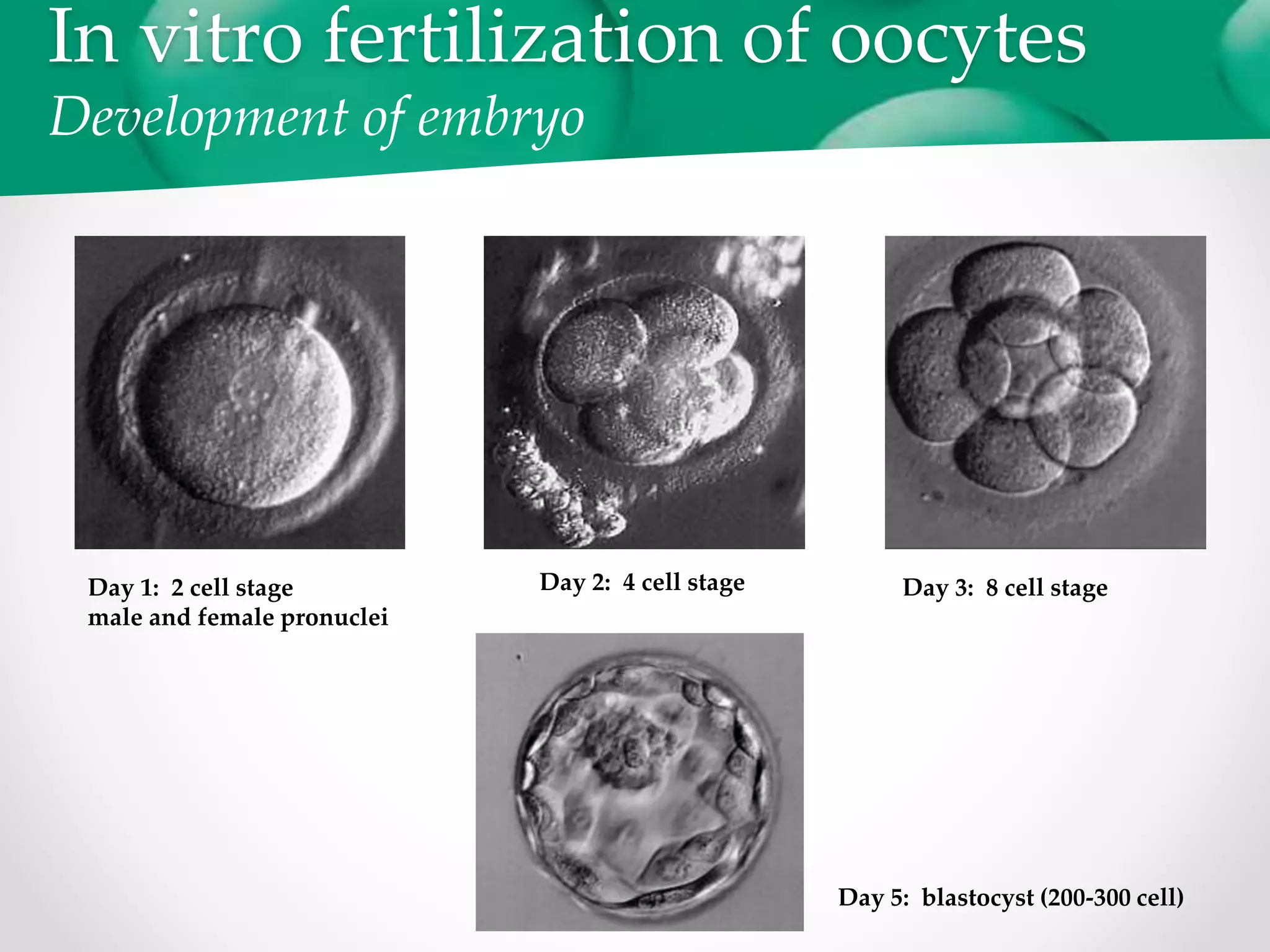 In vitro fertilization | PPTX