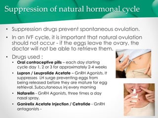 In vitro fertilization | PPTX
