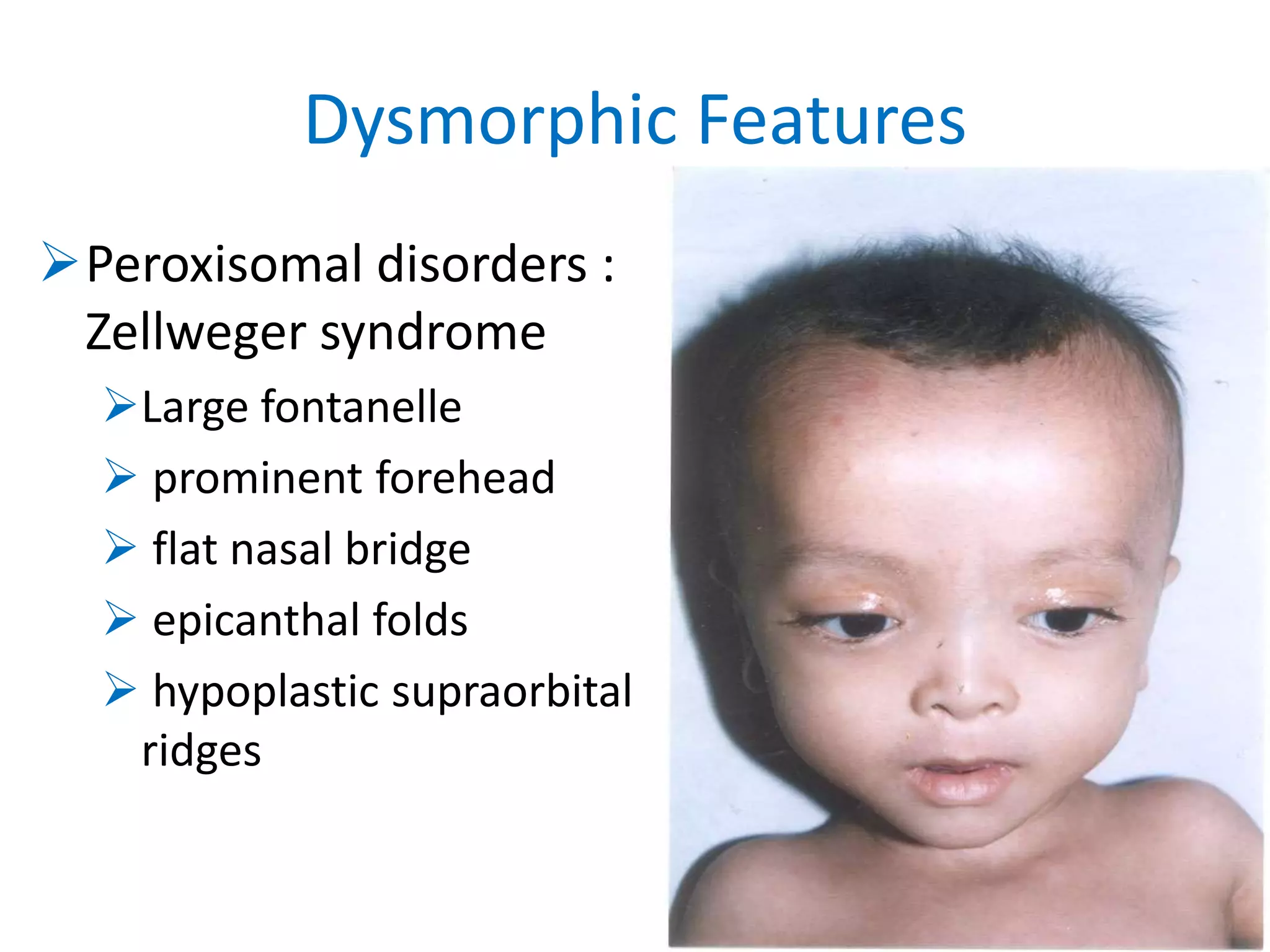 approach to Inborn Errors of Metabolism in neonates | PPTX