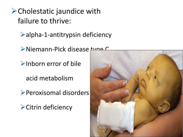approach to Inborn Errors of Metabolism in neonates | PPTX