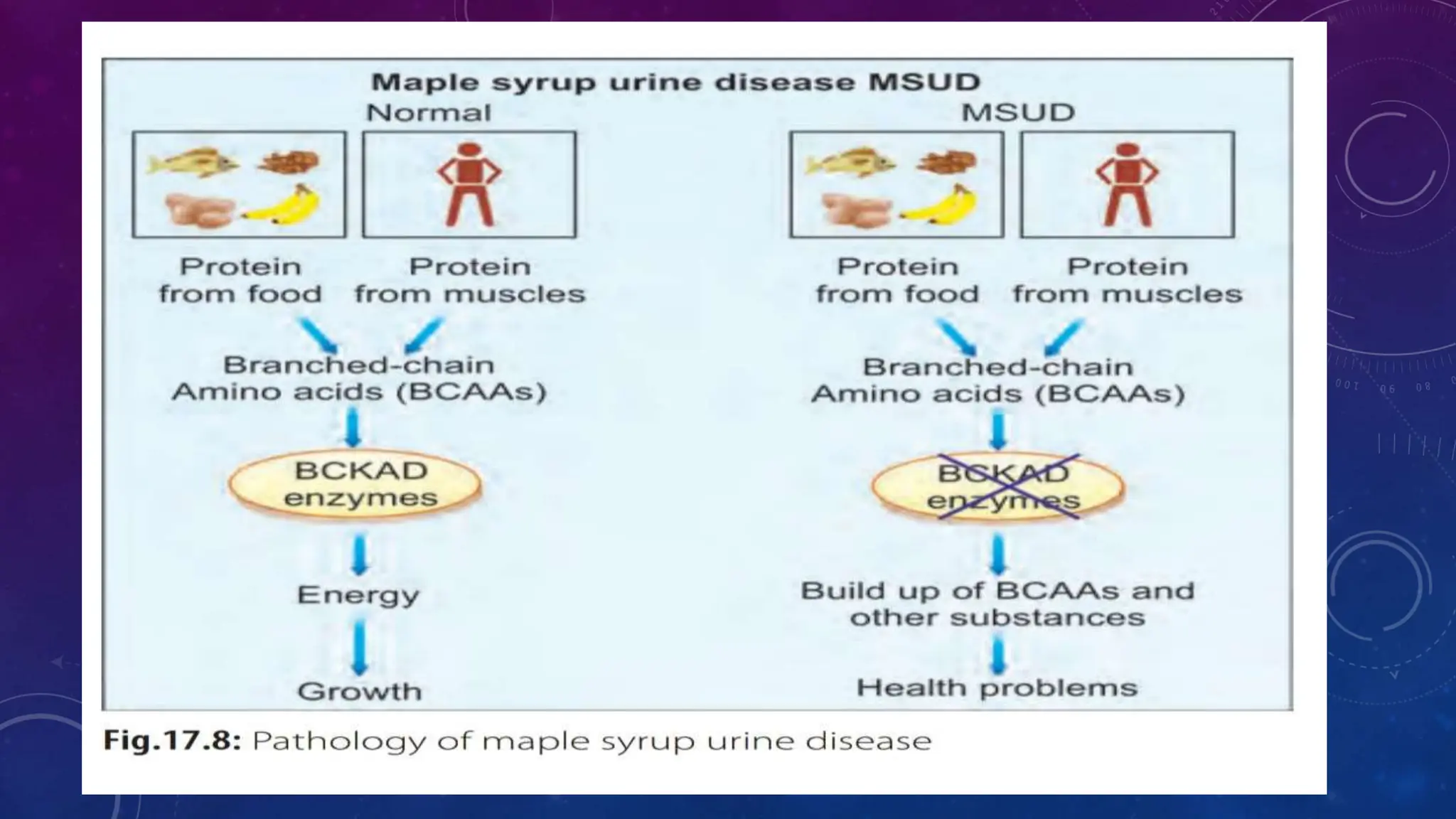 INBORN ERROR OF BRANCHED CHAIN AMINO ACID.pptx