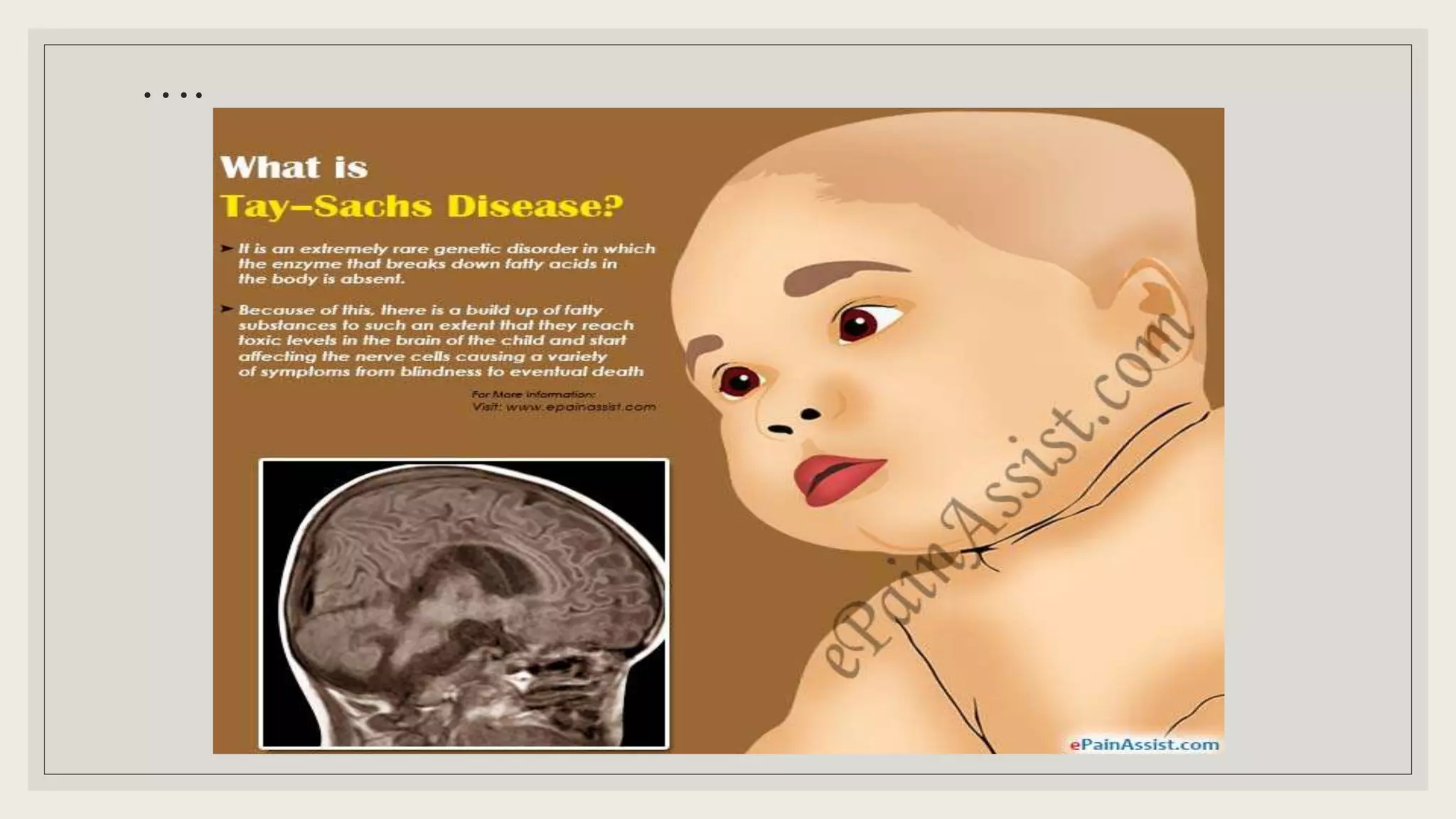 Inborn error of metabolism ppt | PPTX