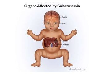 Inborn errors of metabolism | PPTX | Endocrine and Metabolic Diseases ...