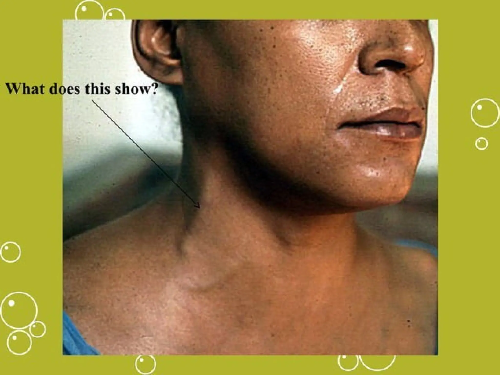 inbound3525251227ghhhhhhhhh814704186.pptx