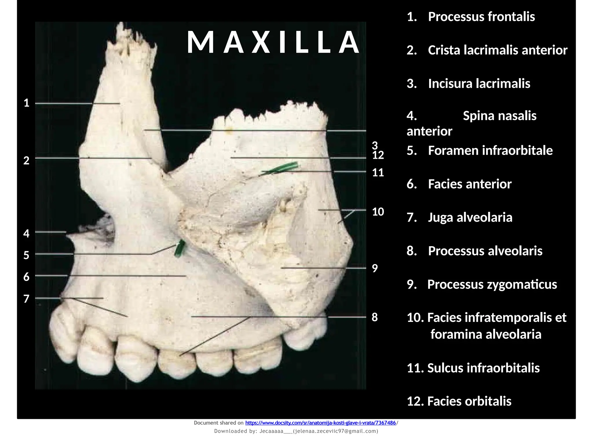 Bonesofhadanatomyfrontalparietalocipital.pptx